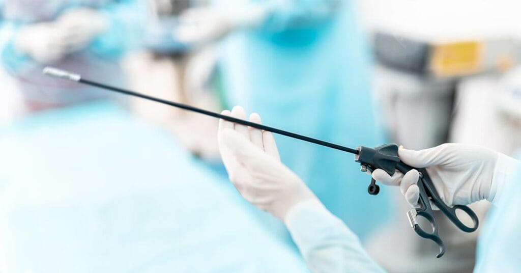 Colorectal Cancer Surgery: Keyhole (Or Laparoscopic) Surgery - Health365.my